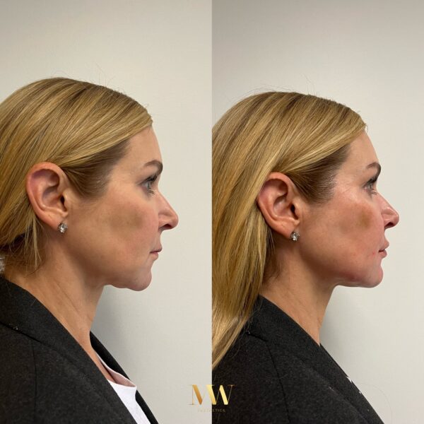 Medwell Aesthetics – Botox & Fillers in Manhattan Beach, CA