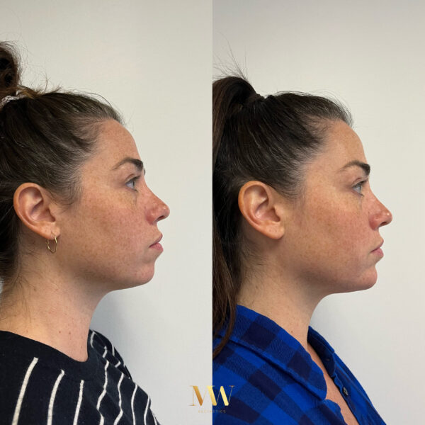 Medwell Aesthetics – Botox & Fillers in Manhattan Beach, CA